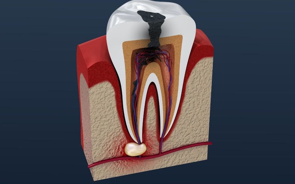 Common Causes of Tooth Pain Beyond Cavities Treatment