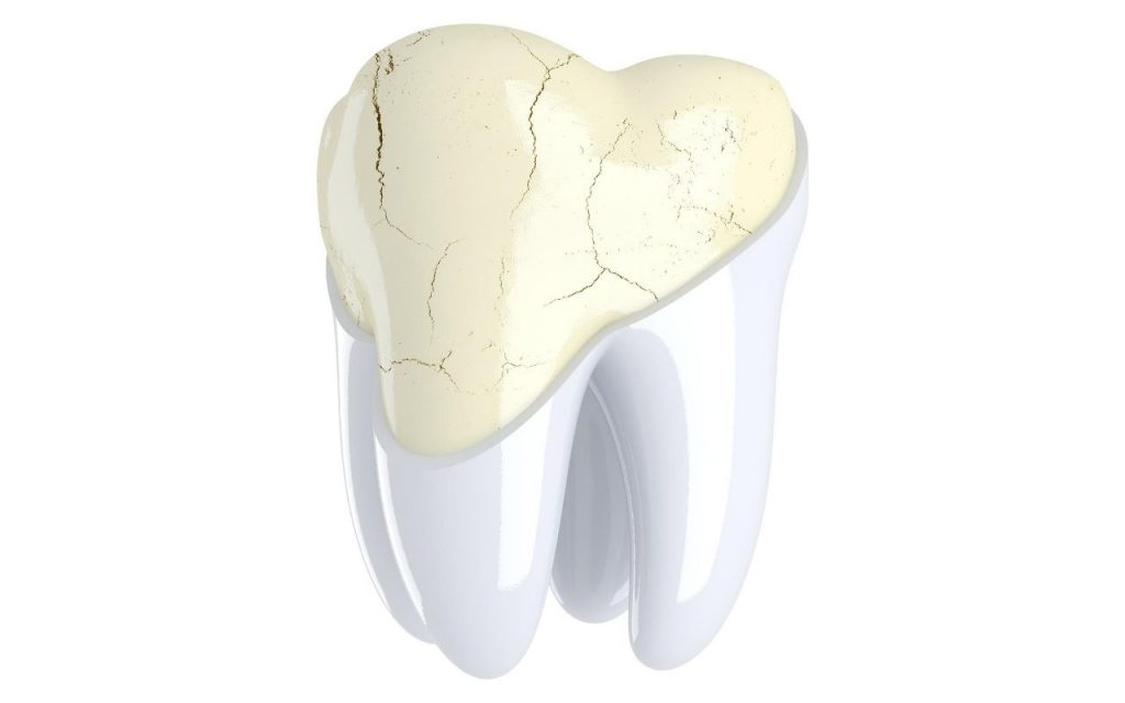 Common Causes of Tooth Pain Beyond Cavities Treatment