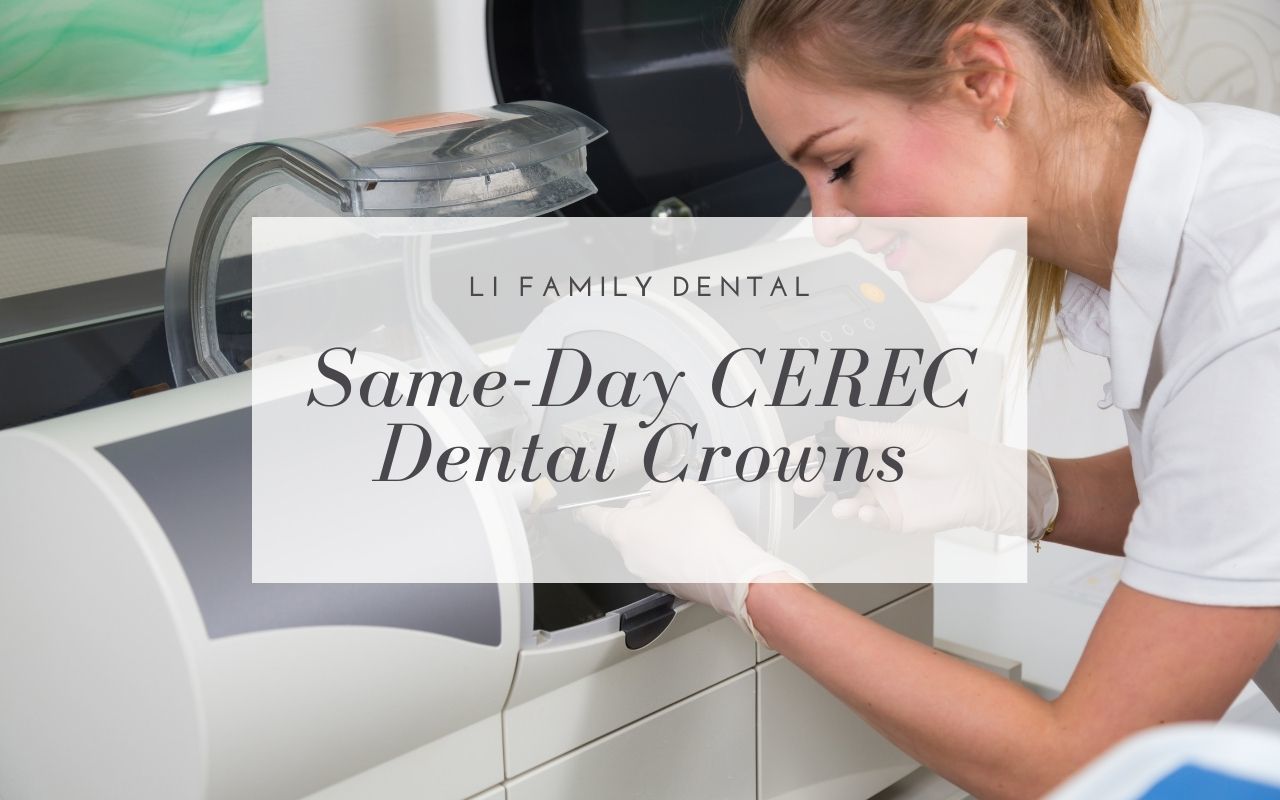 Efficient Same-Day CEREC Dental Crowns at Li Family Dental