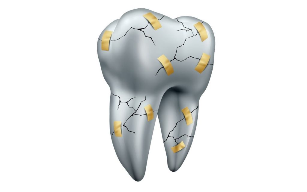 Soft Drinks and Teeth: Dental Insights by Li Family Dental