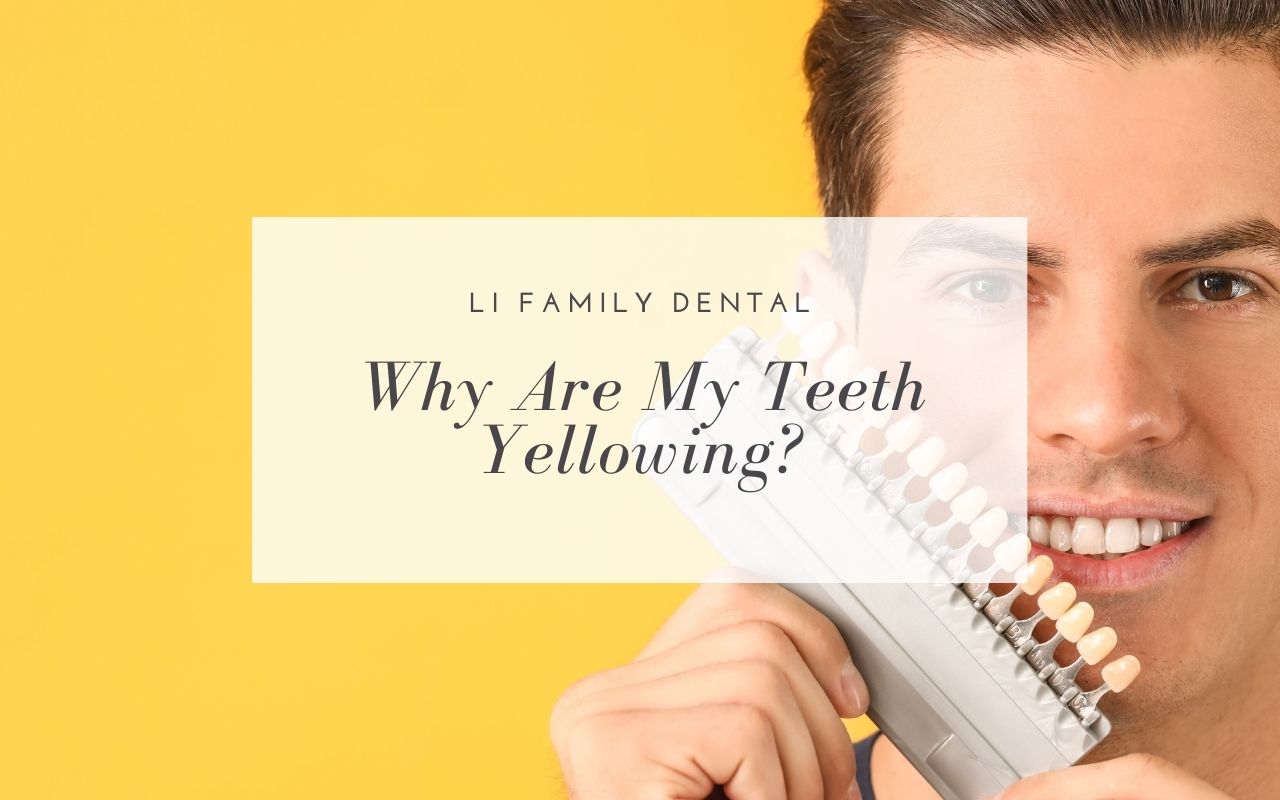 Tooth Discoloration: Li Family Dental, Queensway