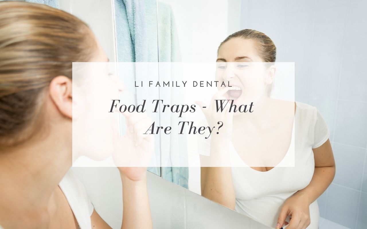 Food Trap Causes and Treatments - Li Family Dental