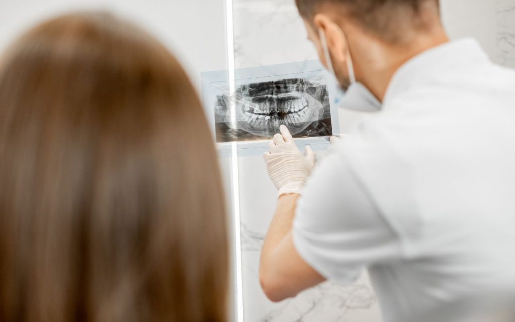 Food Trap Causes and Treatments - Li Family Dental
