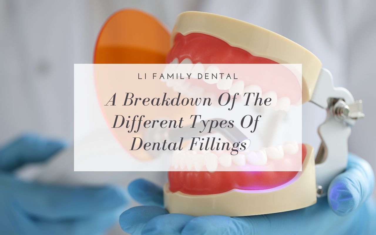 What Are The Different Types Of Dental Fillings at Verda Garcia blog