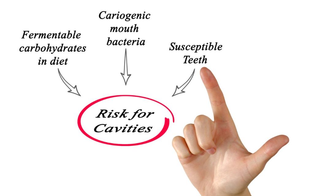 Cavity Care Urged by Li Family Dental - Queensway Dentist