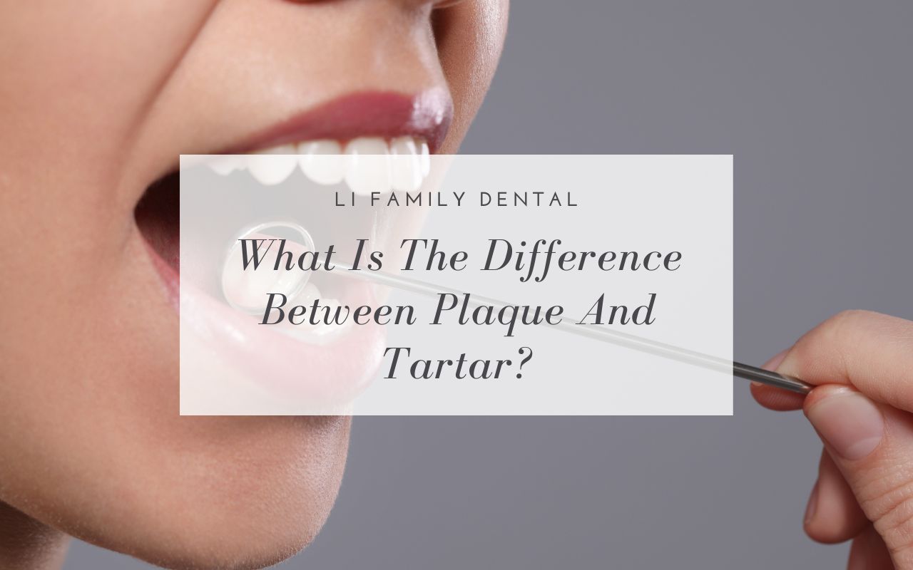 Plaque vs. Tartar: The Distinction - Li Family Dental