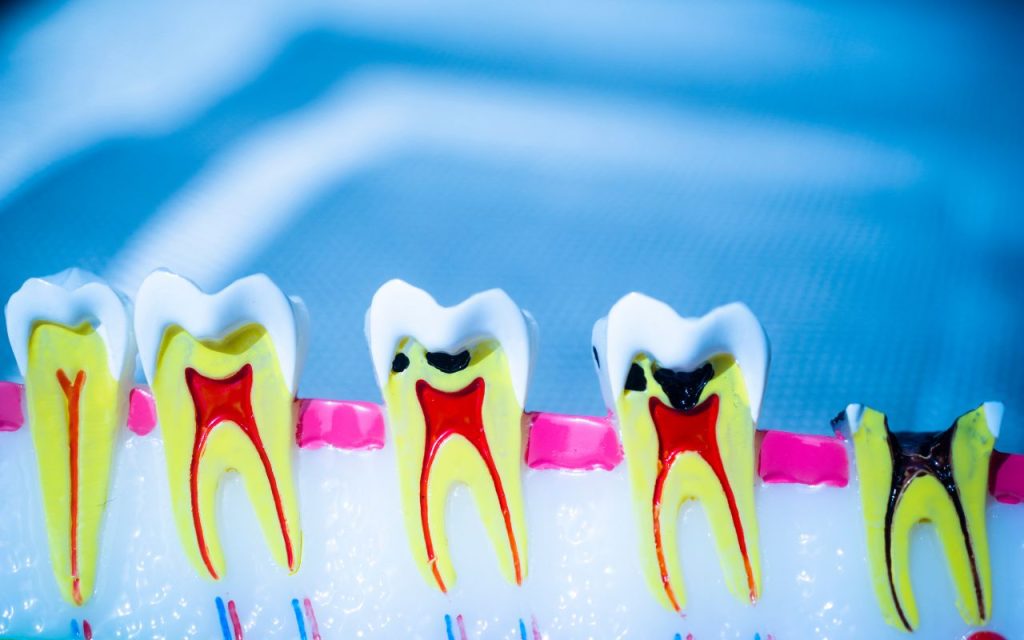 Tooth Health and Energy Drinks Warning - Queensway Dentist