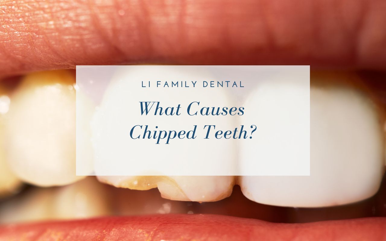 Common Causes of Chipped Teeth - Prevent & Treat Effectively