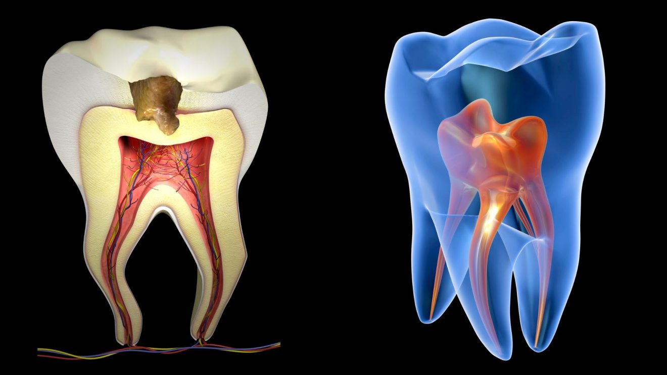 When to See an Endodontist: Li Family Dental's Guide