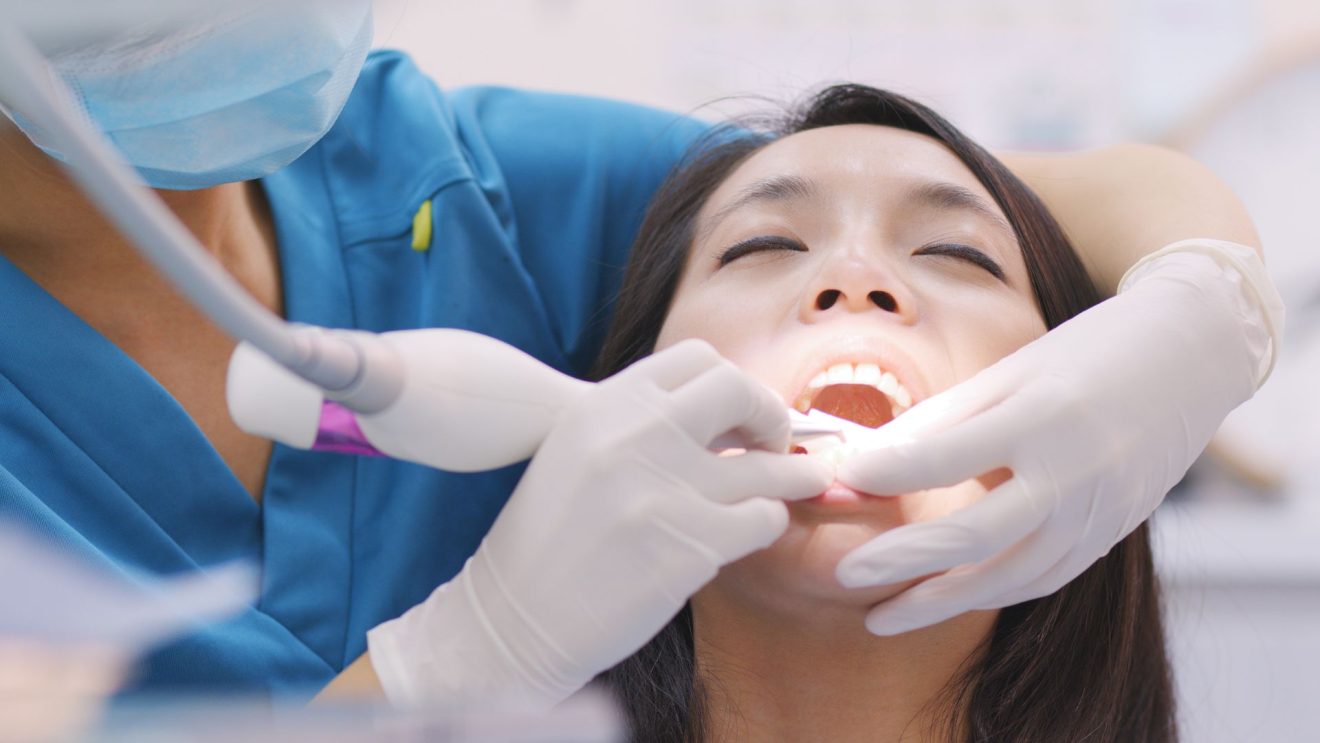 Dental Scaling & Root Planing: Li Family Dental's Guide